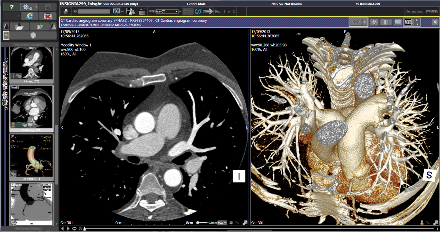 PACS Software Solution | Insignia Medical