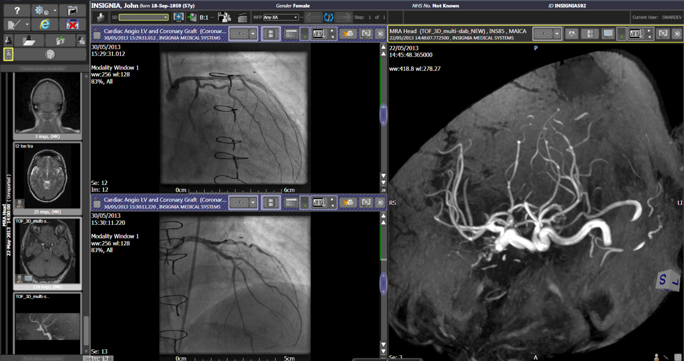 PACS Software Solution | Insignia Medical